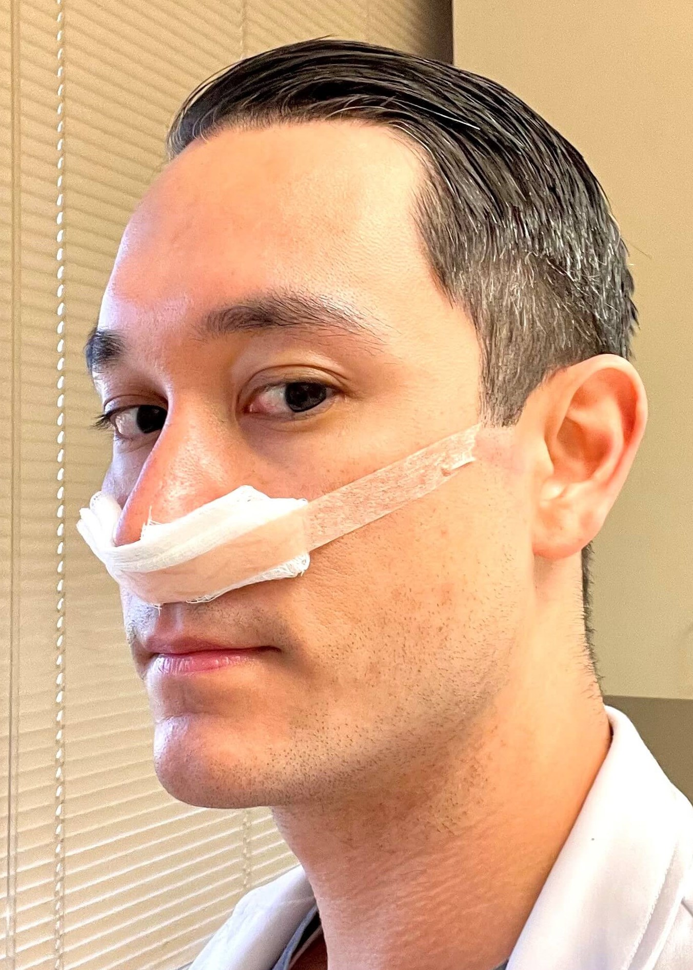 Tips on how to prepare the perfect mustache dressing following nasal ...